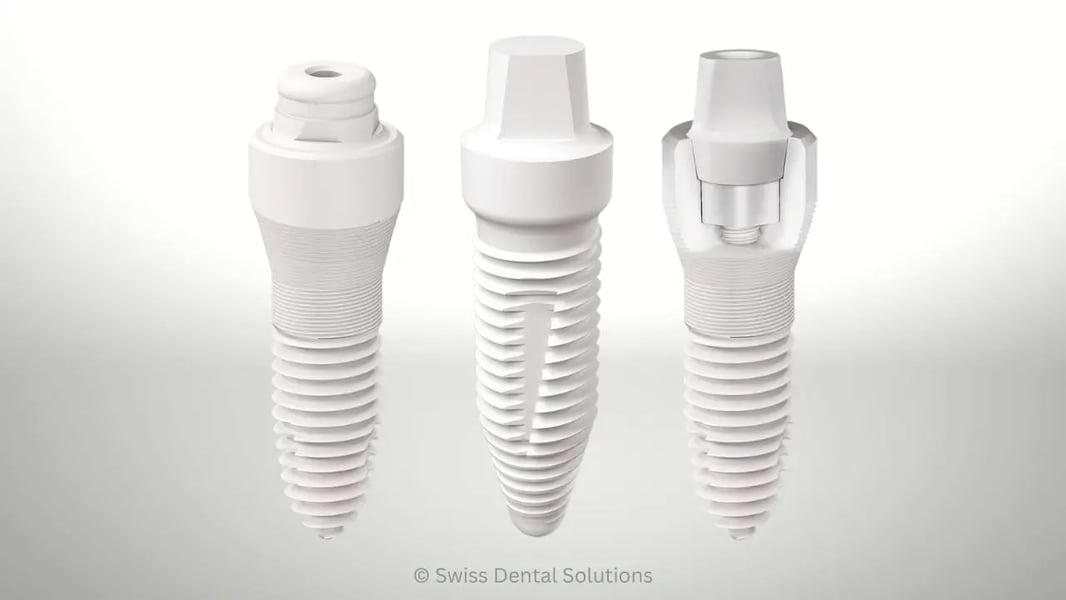 Bioverträgliche Keramik-Implantate | Biologische Zahnmedizin Fritzlar
