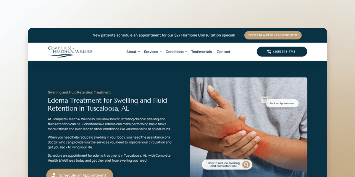Swelling and Fluid Retention - Edema Treatment in Tuscaloosa AL ...