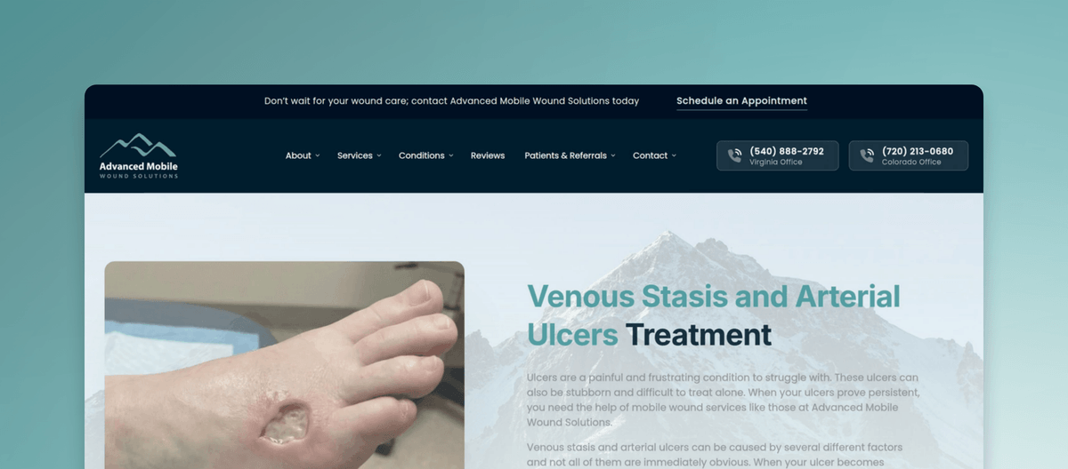 Peripheral Artery and Venous Ulcers Treatment | Expert Care