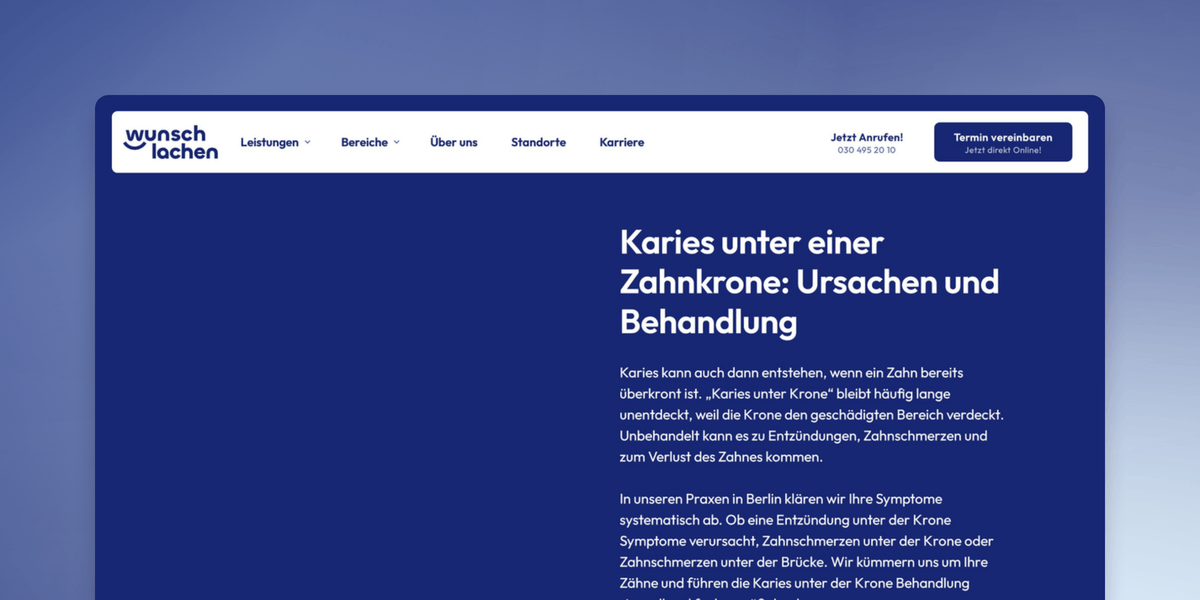 Karies unter Krone? Anzeichen, Risiken und Therapie | Zahnarztpraxis ...
